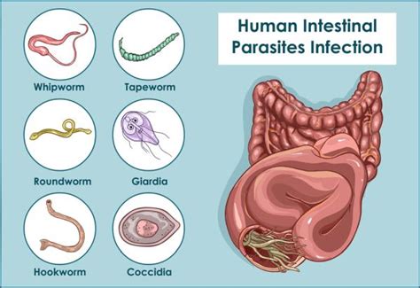 Flatworms In Humans Ppt Medical Helminthology Flatworms—human