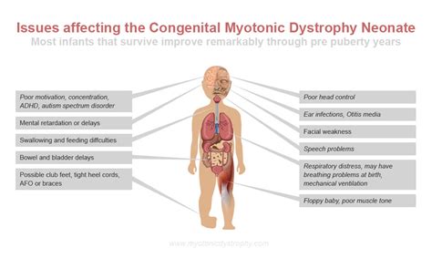 Congenital Myotonic Dystrophy Richard Westons Myotonic Dystrophy Blog