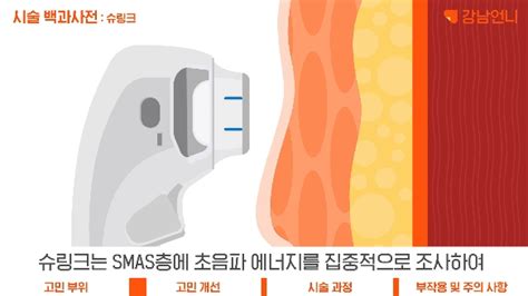 슈링크 자주하면 부작용 생긴다 슈링크 효과 Best 주기 전후 사진 있음 강남언니 1등 성형수술and피부시술 정보앱