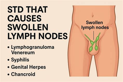 STD That Causes Swollen Lymph Nodes: What You Should Know - Sexual Hood