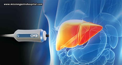 Exploring Fibroscan® Liver Scan A Comprehensive Guide To Non Invasive Liver Health Assessment