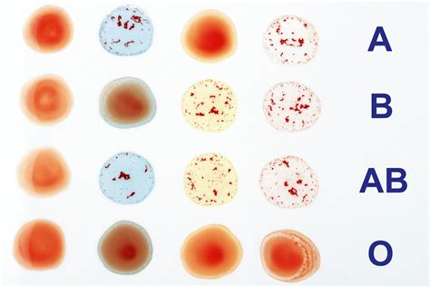 Blodtyper Hvordan Er Blodtyperne Opstået Illviddk