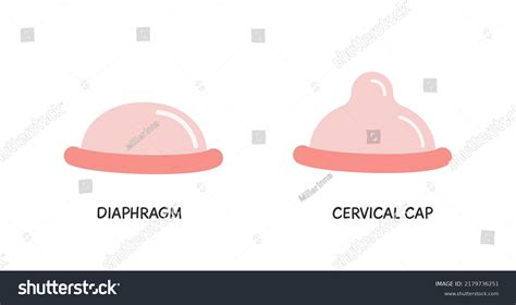 Diaphragm Cervical Cap And Cervical Shield