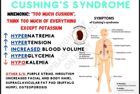 Hypernatremia Mnemonic