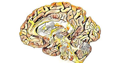 Hemisected Brain Album On Imgur