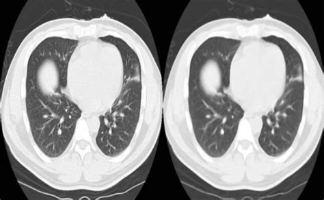 Original Image And Median Filtered Image Download Scientific Diagram
