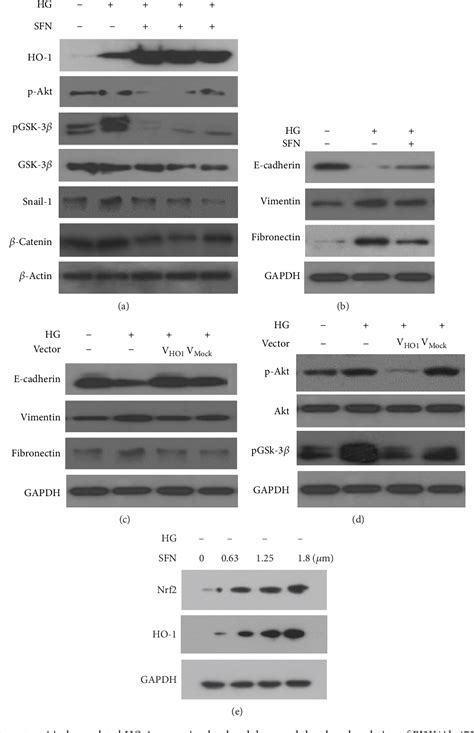 Figure 3 From Nrf2 Heme Oxygenase 1 Attenuates High Glucose Induced