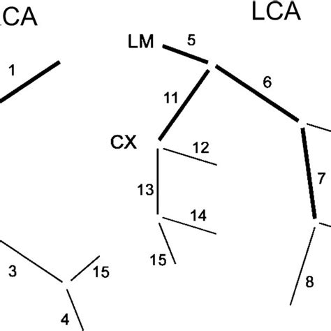 Example Of Coronary Artery Lesion In The High Intravascular Enhancement