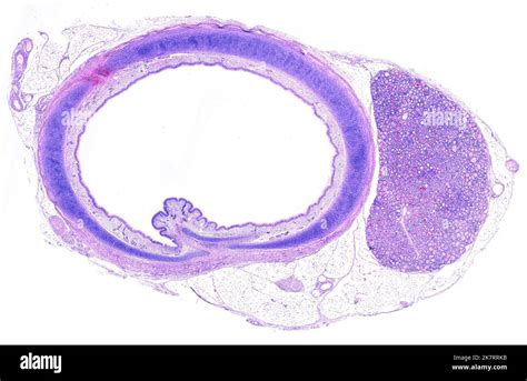 Light Micrograph Of A Cross Section Of The Trachea Showing C Shaped