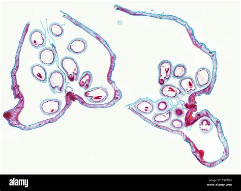 Shepherds Purse Capsella Embryos Seen Through A Microscope Stock