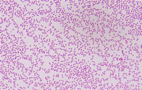Pasteurella Multocida Gram Stain Pure Culture Of Pasteurel Flickr