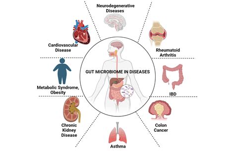 Diseases Associated With Gut Microbiome Dysregulation Biorender