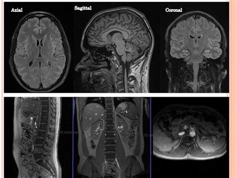 Basic About Radiology And Imagingpdf