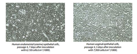 Female Reproductive Epithelial Culture Medium