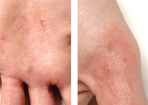 Pictures Of Fiberglass Rash Glass Designs