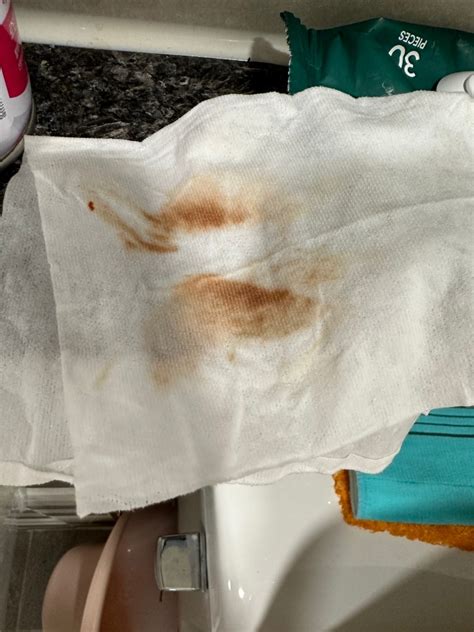 항문 사진 주의 지식in