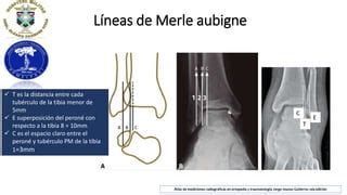 Angelis Mediciones Radiologicaspptx