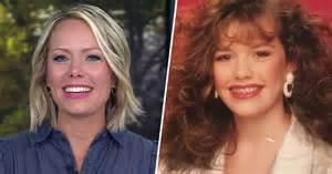 See Today Anchors With Braces