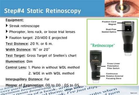 21 Step Diagnosis Procedure Refraction Pptx