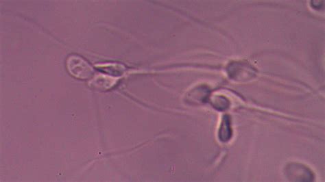 Zymot Fertility Symposia Ivf News