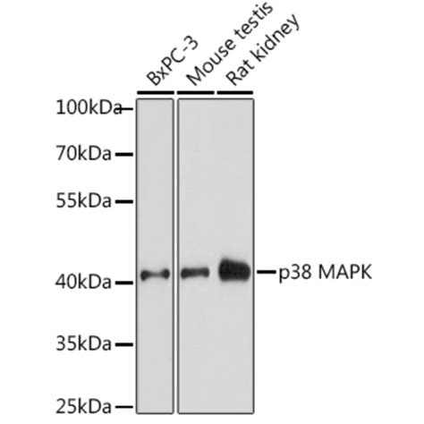 Anti P38 Alphamapk14 Antibody A89761