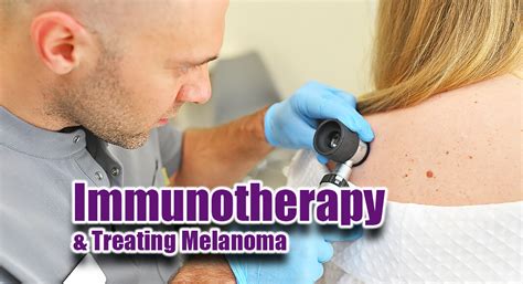 How New Immunotherapy Is Helping To Treat Melanoma Mega Doctor News