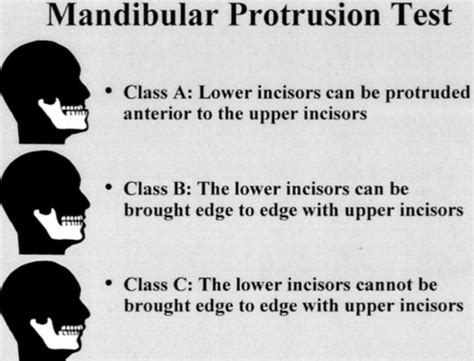 Airway Management Flashcards Quizlet