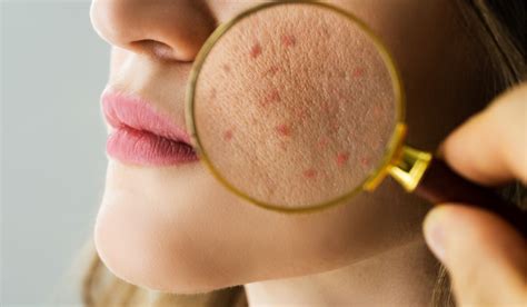 Abilify Weight Gain Causes Risks And Management