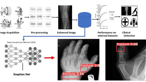 Computer Vision In Medical Imaging Cvmi Research Jio Institute