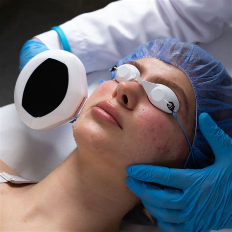 How To Get Rid Of Post Inflammatory Hyperpigmentation Acibadem