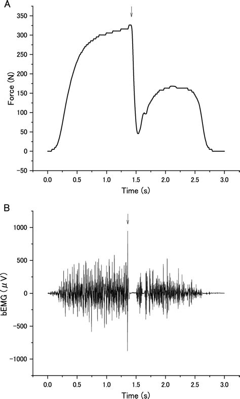 Typical Recordings Of Handgrip Force And Background Electromyography Download Scientific