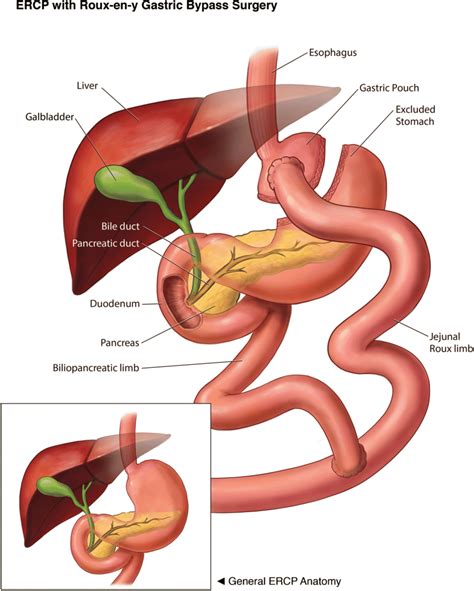 Roux Y Gastric Bypass Anatomy A Anatomical Components Of Roux En Y