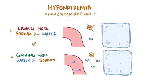 Hyponatremia Osmosis