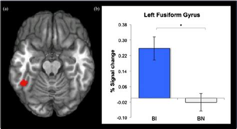 Color Online Receipt Of Feedback In The Whole Brain Analysis A