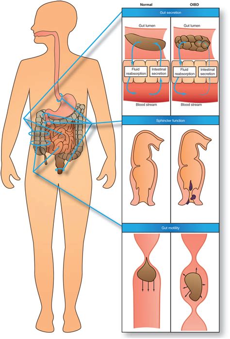 Pathophysiology Of Opioid Induced Bowel Dysfunction First Row Download Scientific Diagram