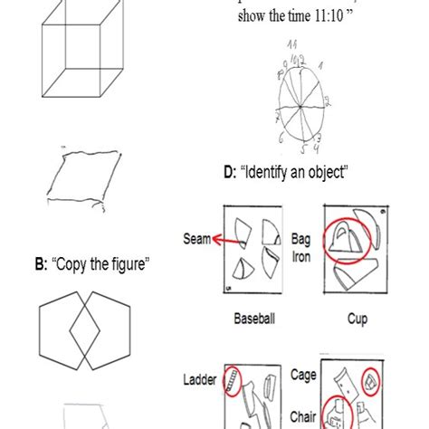 1 Visuo Spatial Assessment Of The Dlb Patients A B Necker Cube A Download Scientific