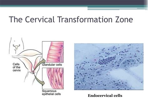 Ppt New Screening Guidelines For The Female Patient Powerpoint