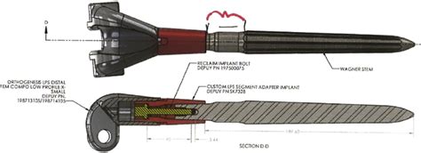 Custom Adapter Design To Mate A Hinged Knee Femoral Prosthesis To The Download Scientific