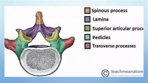 Prolapsed Intervertebral Disc Ppt Slideshare Pptx