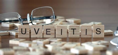 Uveitis Diagnosis And Treatment Of Inflammatory Eye Diseases Sugoii Teaching Teaching