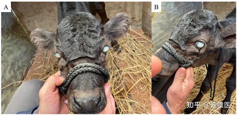 日本黑犊脐部感染相关的感染性眼内炎 知乎