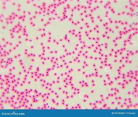 Globules Rouges De Poulet Sous Un Microscope Poulet De Calomnie De