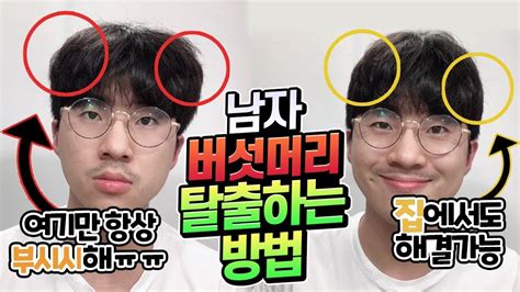 남자 부시시한 머리부스스한 머리 해결방법남자 버섯머리 탈출하는 방법 Youtube