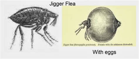 Tunga Penetrans