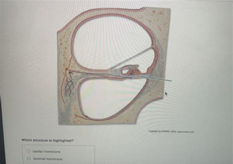 Solved Somo 2010 Which Structure Is Highlighted Basilar