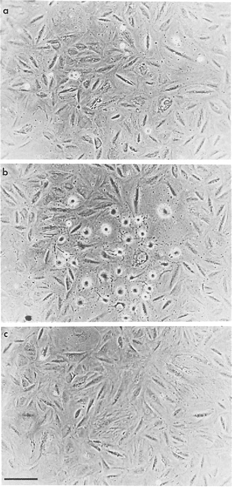 Figure 3 From Regulation Of Actin Microfilament Integrity In Living Nonmuscle Cells By The Camp