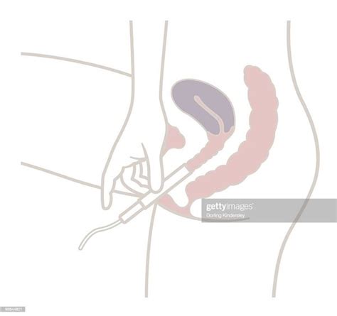 Putting In A Tampon Diagram