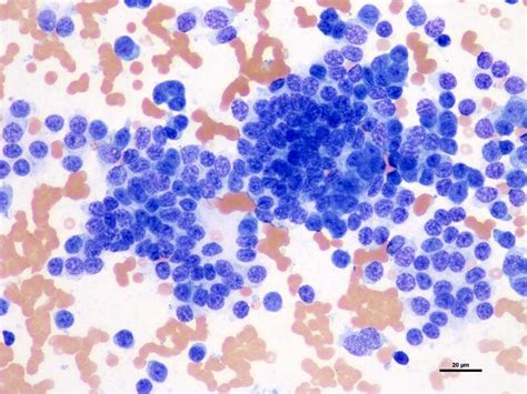 Citología Hepática En El Perro Y El Gato Clinlabvet Revista Clínica