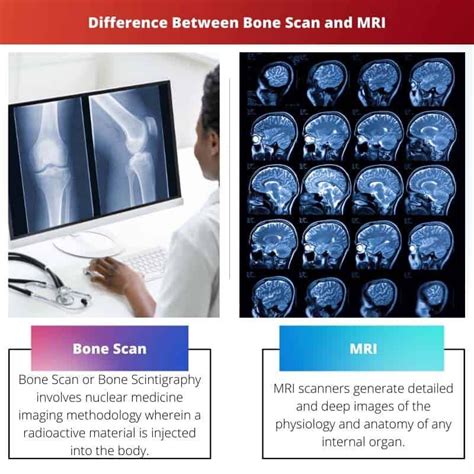 Bone Scan Vs Mri Difference And Comparison