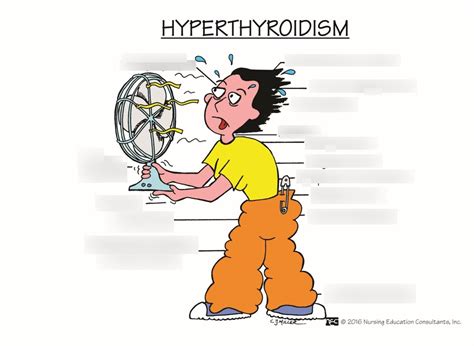 Hyperthyroidism Illustration Diagram Quizlet